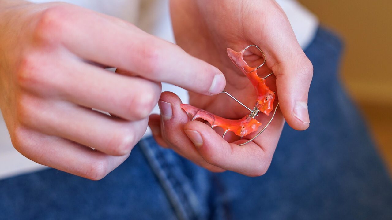 Maxillary Expansion: A Complete Guide | Birmingham Orthodontics